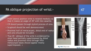 RADIOGRAPHIC TECHNIQUE OF UPPER LIMB BY SAGAR CHAULAGAIN | PPTX