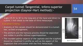 RADIOGRAPHIC TECHNIQUE OF UPPER LIMB BY SAGAR CHAULAGAIN | PPTX