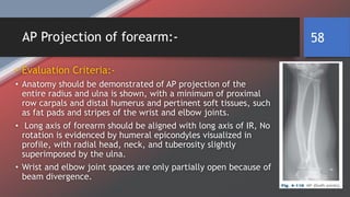 RADIOGRAPHIC TECHNIQUE OF UPPER LIMB BY SAGAR CHAULAGAIN | PPTX
