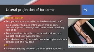 RADIOGRAPHIC TECHNIQUE OF UPPER LIMB BY SAGAR CHAULAGAIN | PPTX