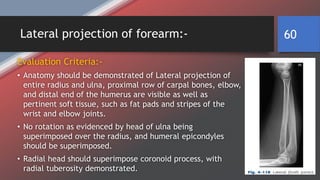 RADIOGRAPHIC TECHNIQUE OF UPPER LIMB BY SAGAR CHAULAGAIN | PPTX