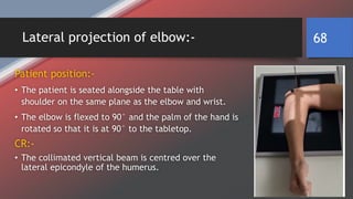 RADIOGRAPHIC TECHNIQUE OF UPPER LIMB BY SAGAR CHAULAGAIN | PPTX