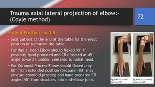 RADIOGRAPHIC TECHNIQUE OF UPPER LIMB BY SAGAR CHAULAGAIN | PPTX