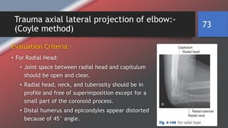 RADIOGRAPHIC TECHNIQUE OF UPPER LIMB BY SAGAR CHAULAGAIN | PPTX