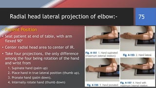 RADIOGRAPHIC TECHNIQUE OF UPPER LIMB BY SAGAR CHAULAGAIN | PPTX