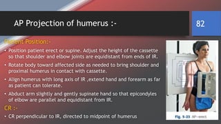 RADIOGRAPHIC TECHNIQUE OF UPPER LIMB BY SAGAR CHAULAGAIN | PPTX
