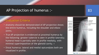 RADIOGRAPHIC TECHNIQUE OF UPPER LIMB BY SAGAR CHAULAGAIN | PPTX