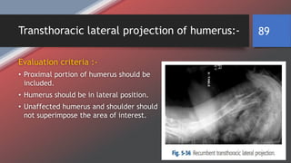 RADIOGRAPHIC TECHNIQUE OF UPPER LIMB BY SAGAR CHAULAGAIN | PPTX