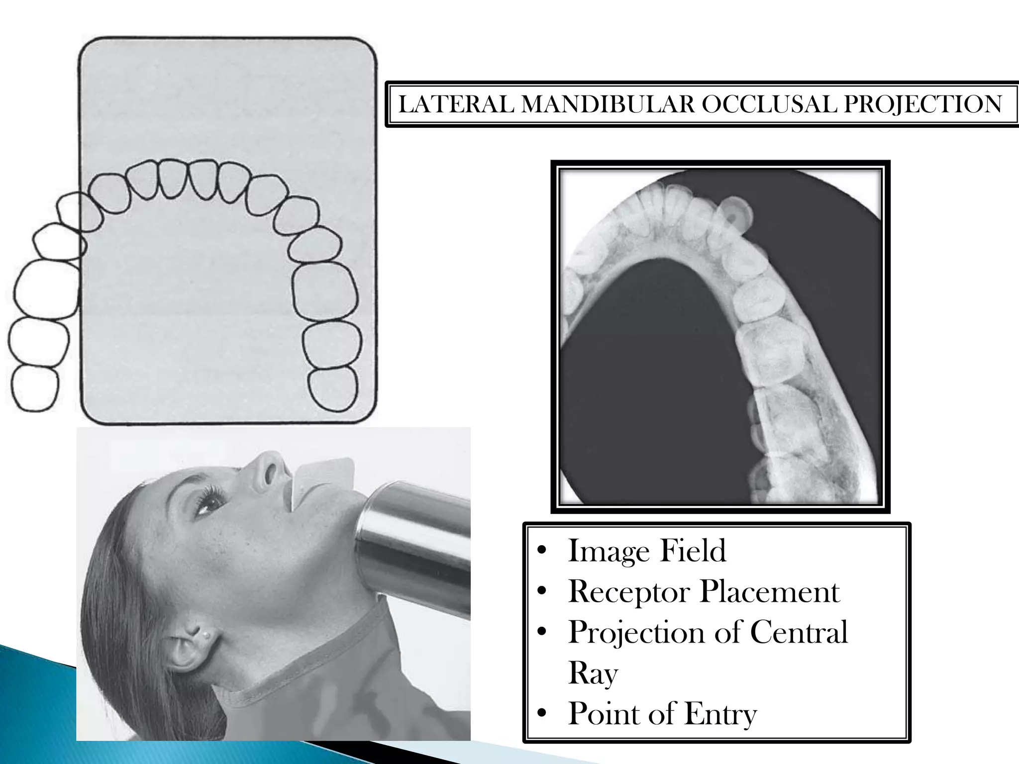 Radiographic techniques | PPTX