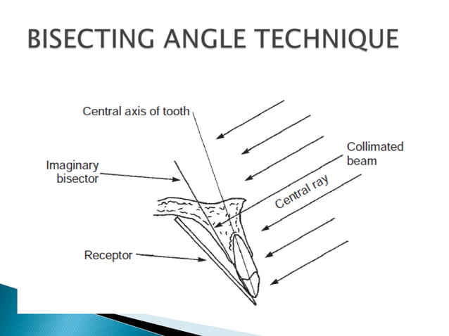 Radiographic techniques | PPTX | Dental Health | Diseases and Conditions