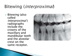 Radiographic techniques | PPTX