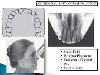 Radiographic techniques | PPTX