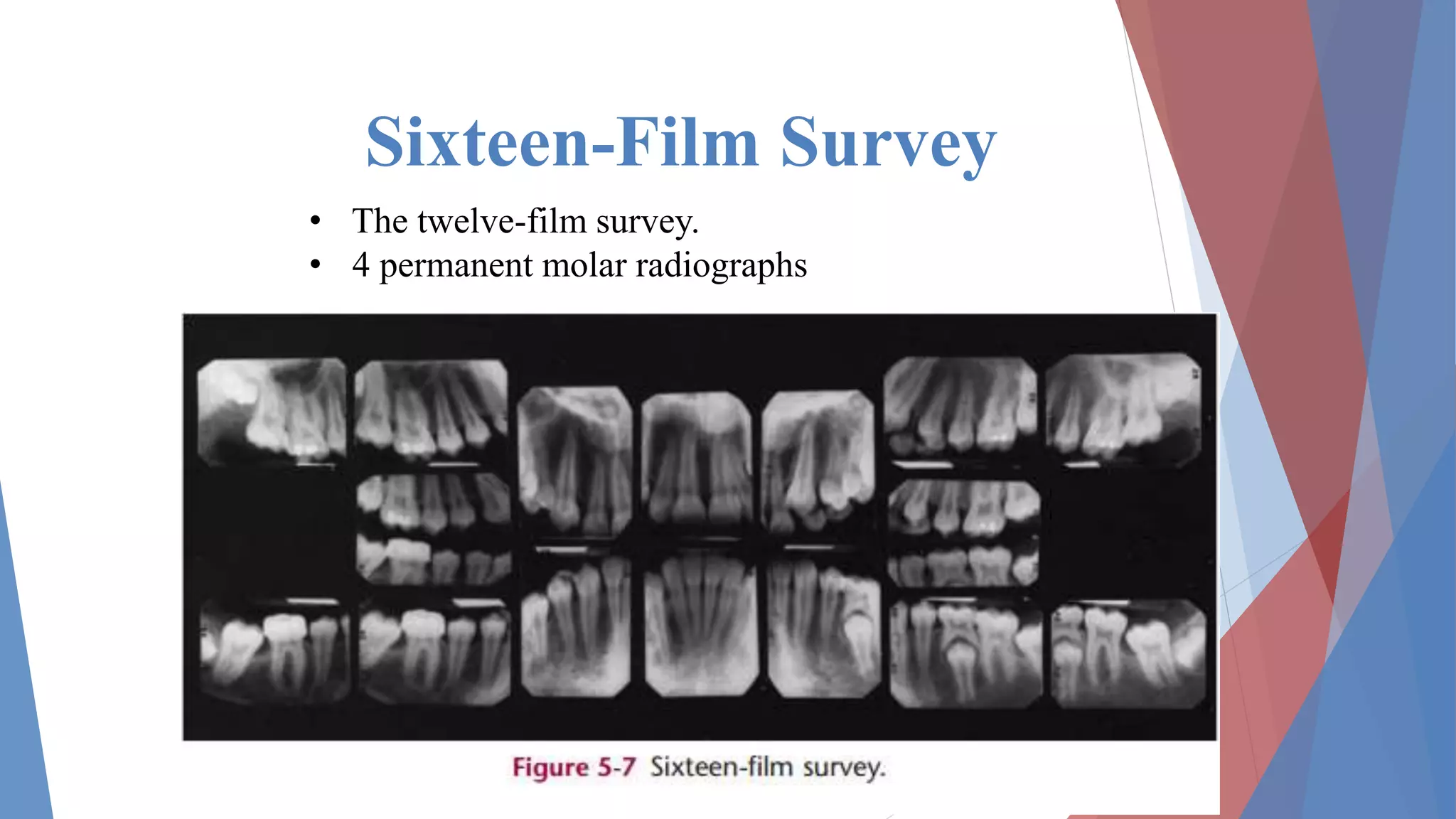 Radiographic Techniques.pptx