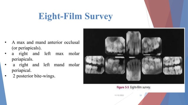 Radiographic Techniques.pptx