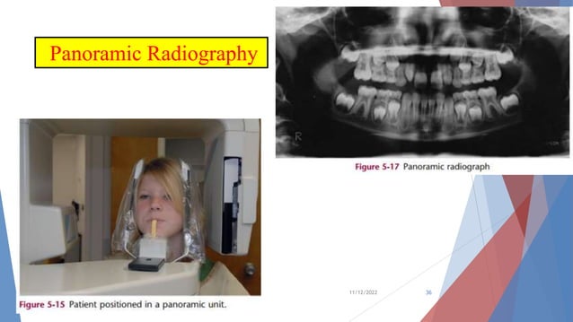 Radiographic Techniques.pptx