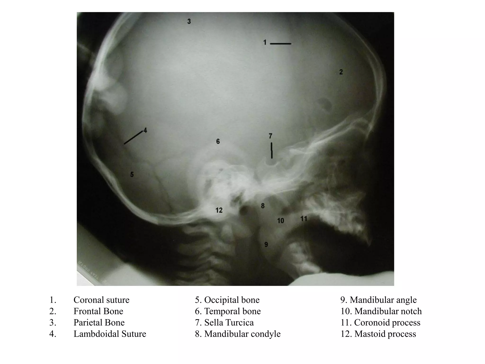 Radiographic views.ppt