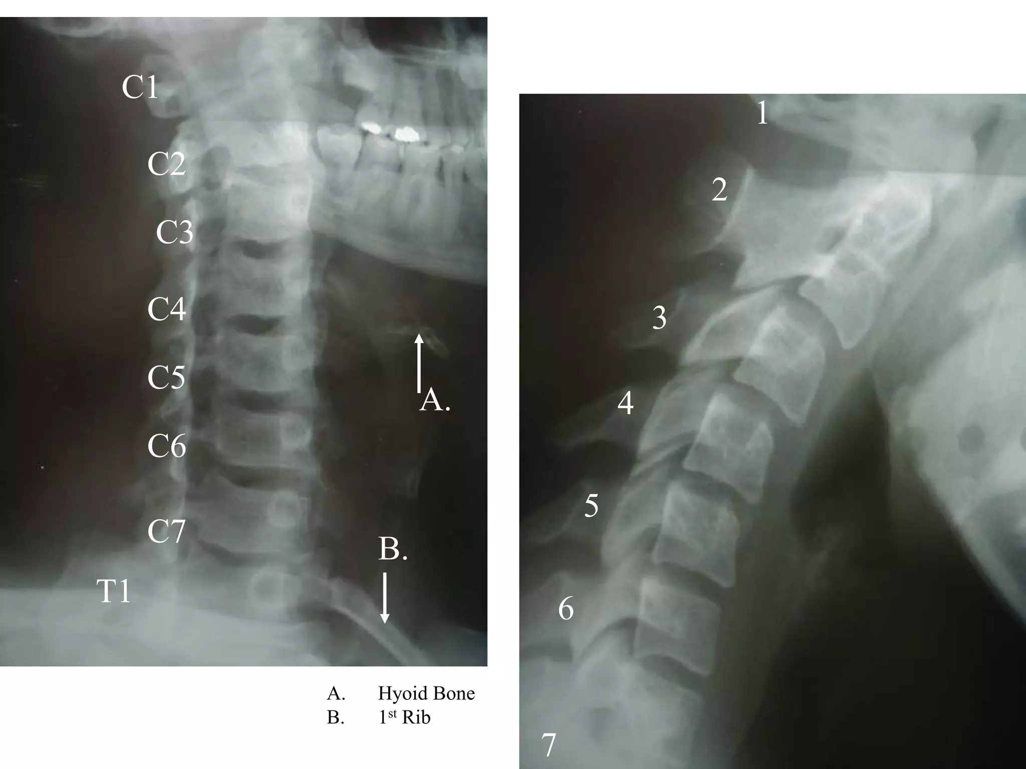 Radiographic views.ppt