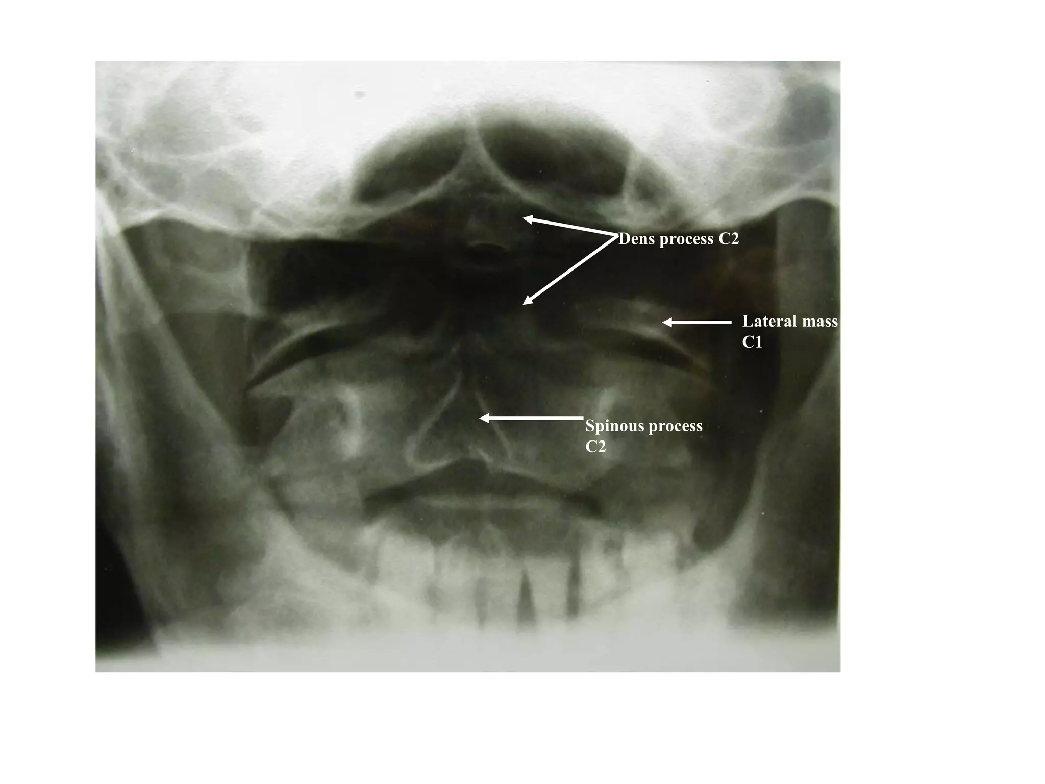 Radiographic views.ppt