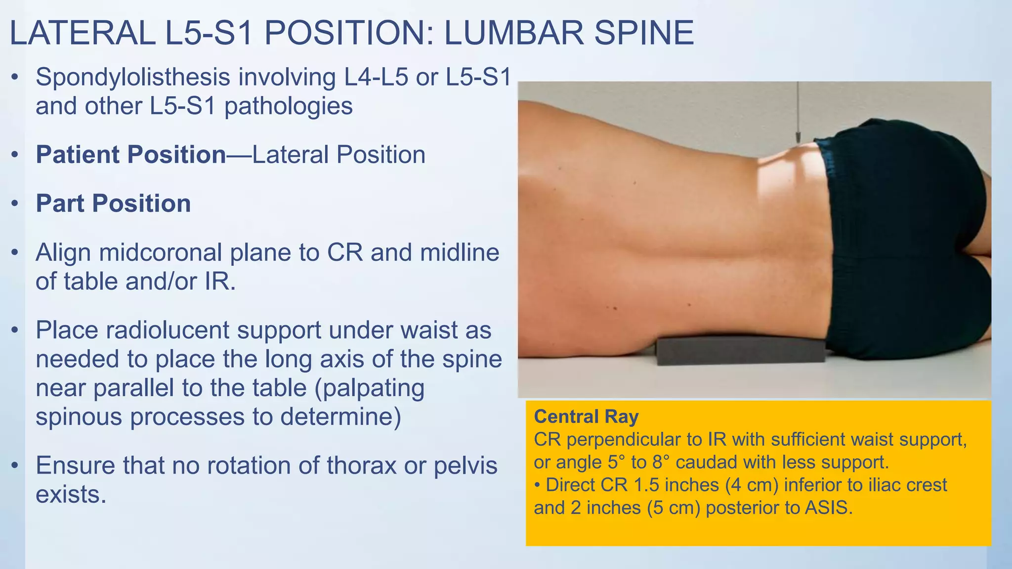 Radiographic views of lumbar spine | PPTX