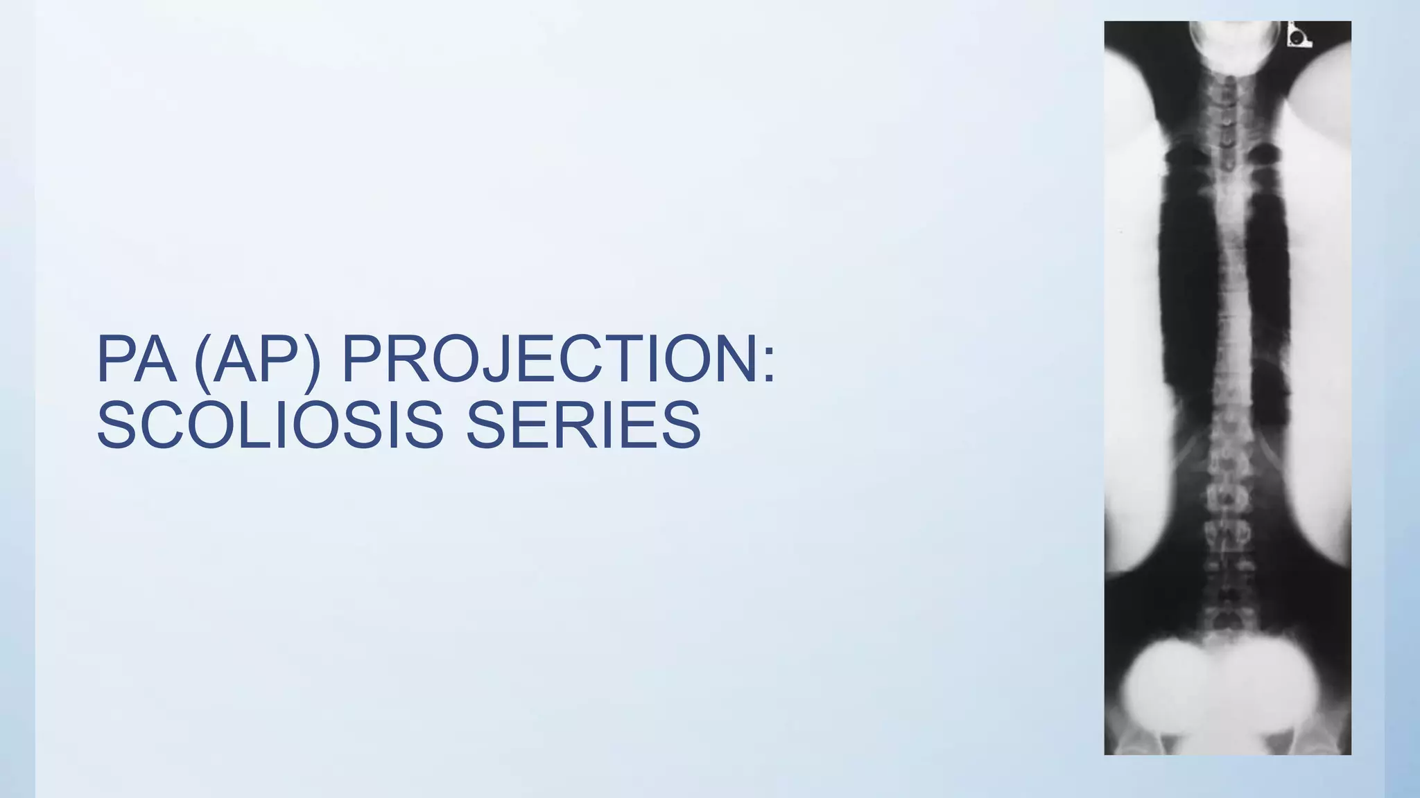 Radiographic views of lumbar spine | PPTX