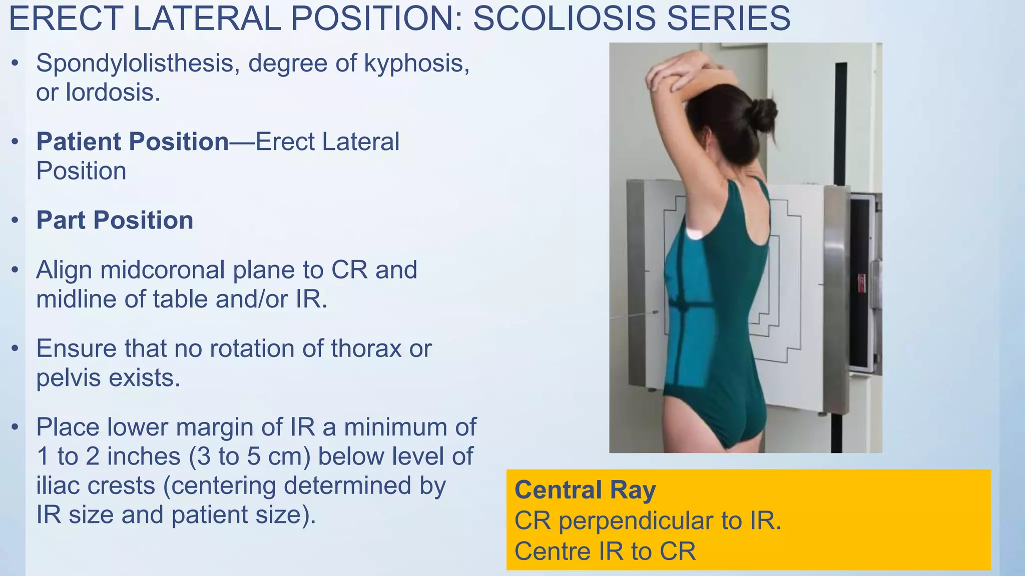 Radiographic views of lumbar spine | PPTX