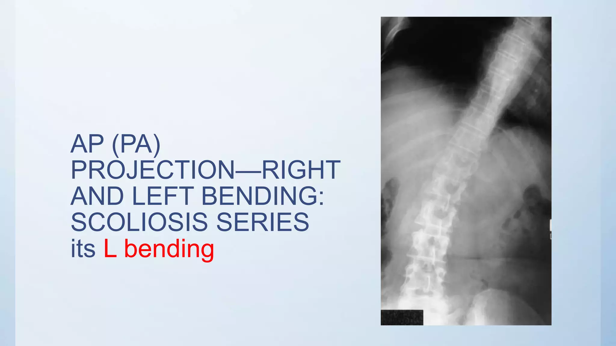 Radiographic views of lumbar spine | PPTX