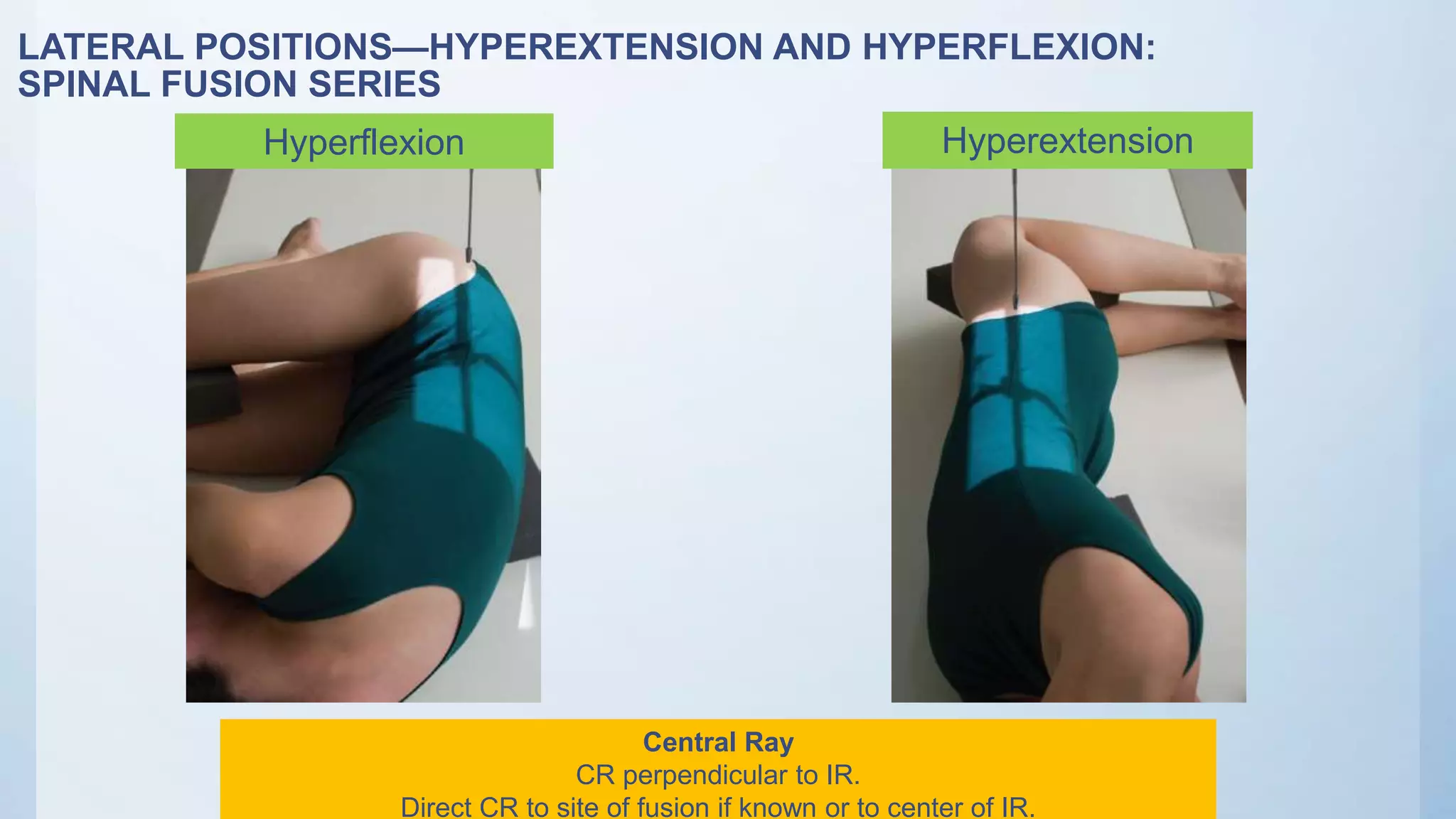 Radiographic views of lumbar spine | PPTX