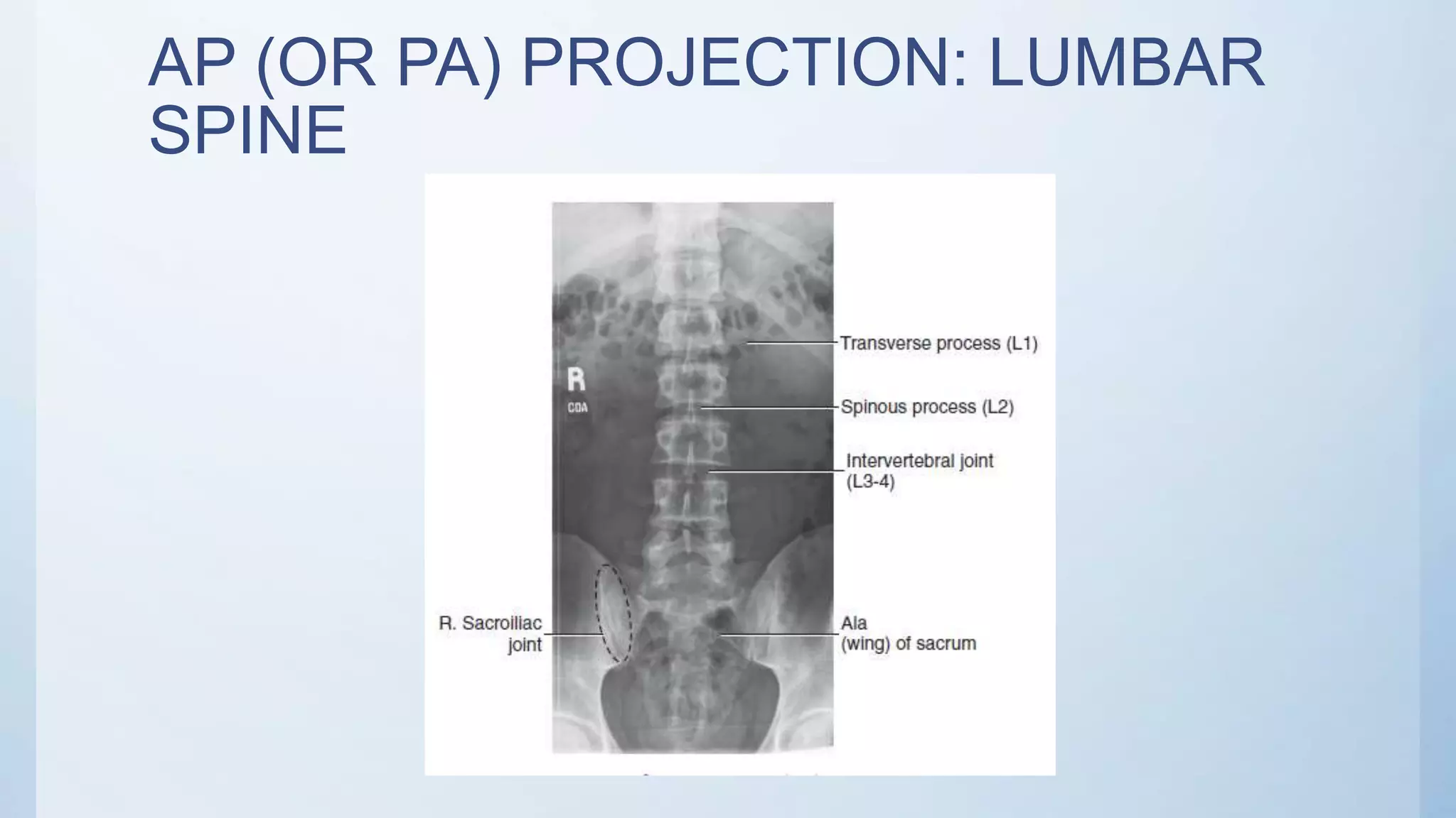 Radiographic views of lumbar spine | PPTX