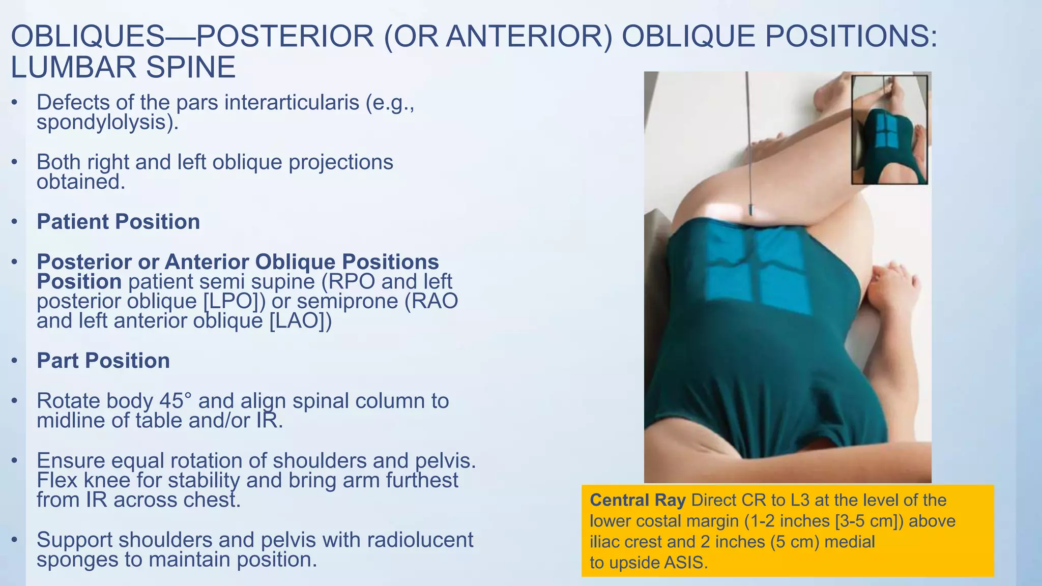 Radiographic views of lumbar spine | PPTX