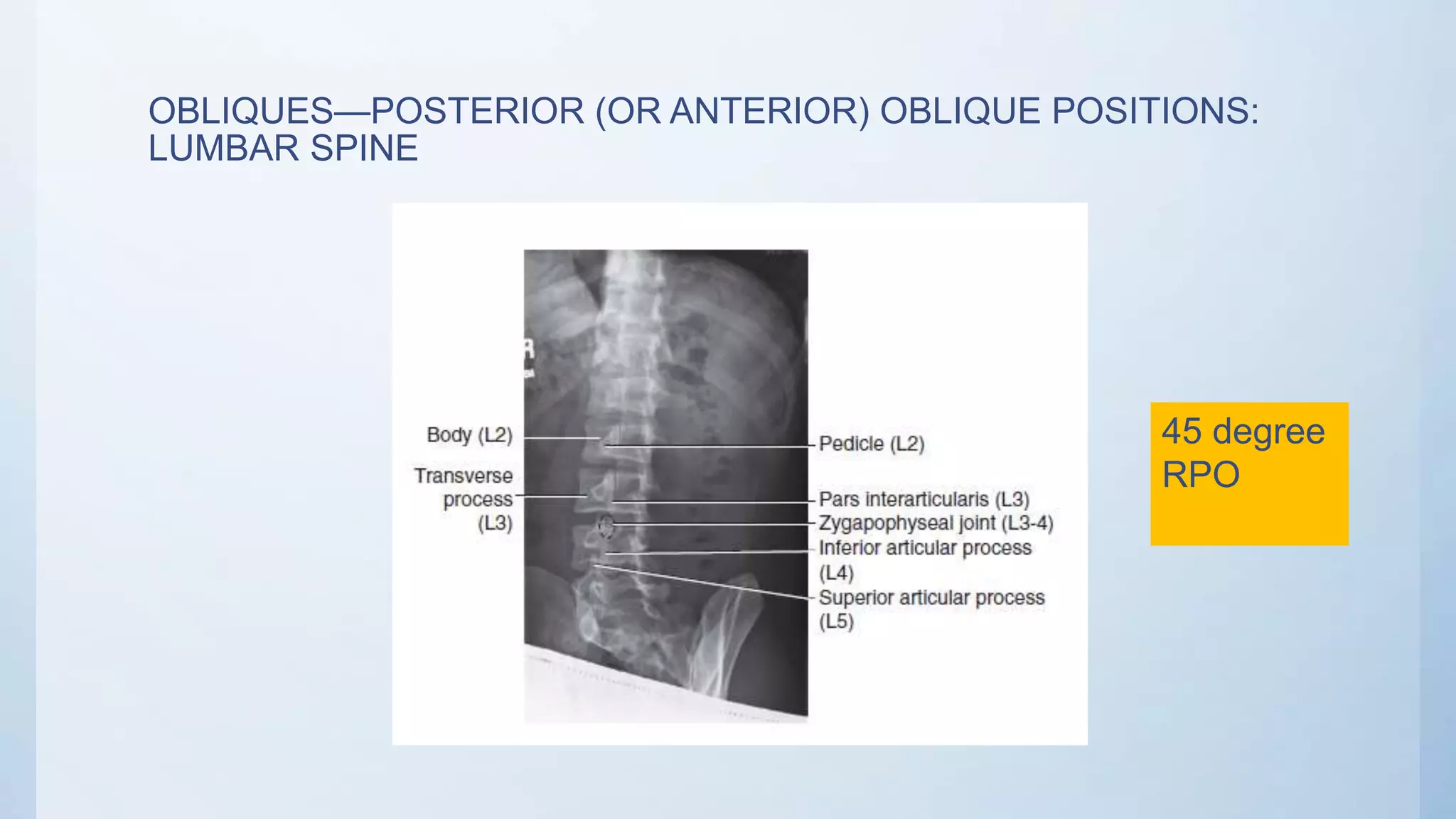 Radiographic views of lumbar spine | PPTX