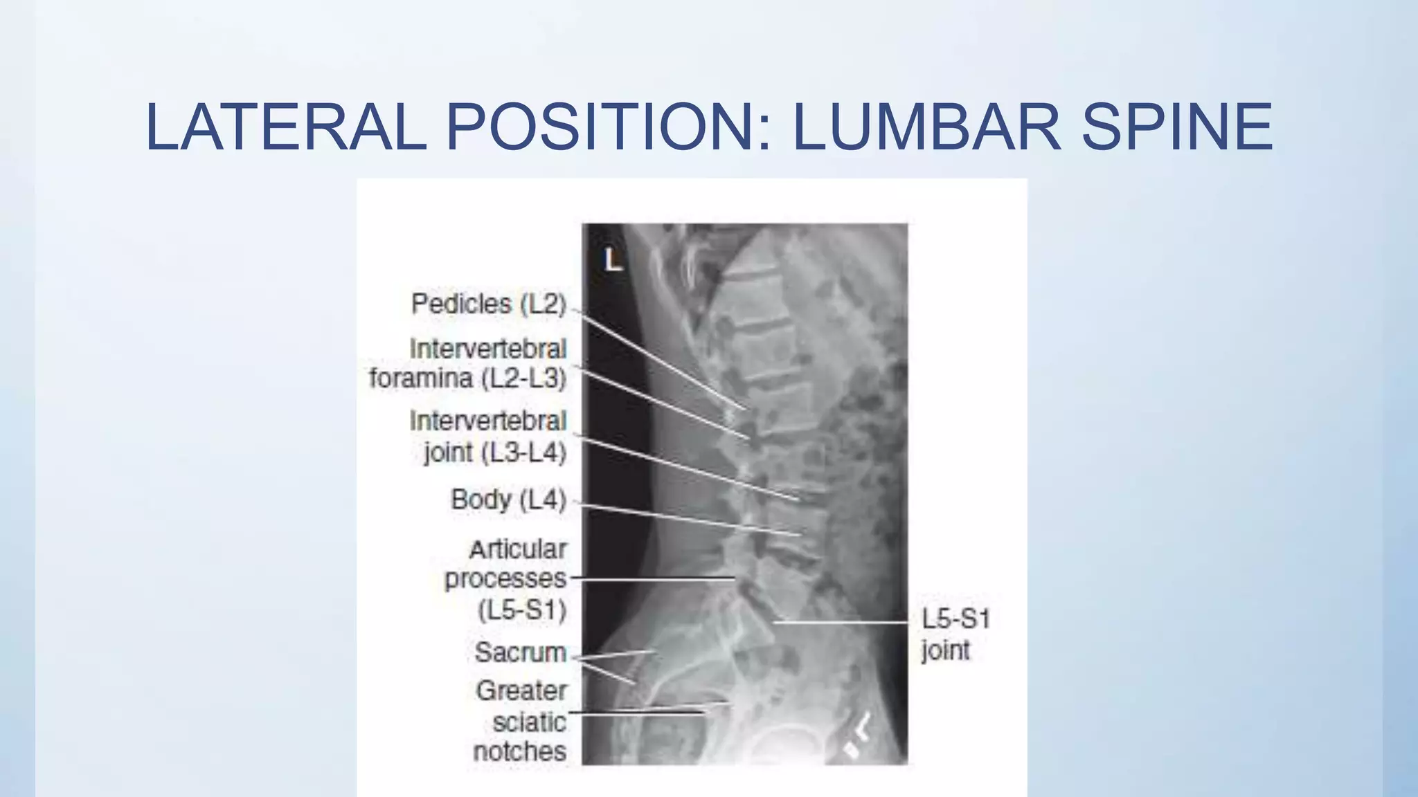 Radiographic views of lumbar spine | PPTX