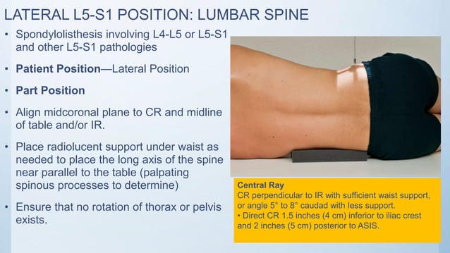 Radiographic views of lumbar spine | PPTX