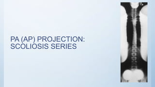 Radiographic views of lumbar spine | PPTX