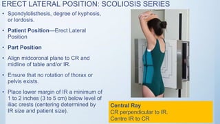 Radiographic views of lumbar spine | PPTX