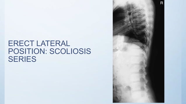 Radiographic views of lumbar spine | PPTX