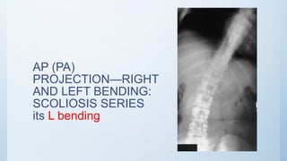 Radiographic views of lumbar spine | PPTX