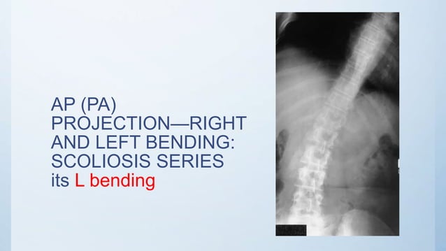 Radiographic views of lumbar spine | PPTX