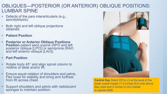 Radiographic views of lumbar spine | PPTX