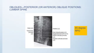 Radiographic views of lumbar spine | PPTX