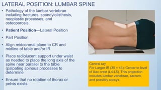 Radiographic views of lumbar spine | PPTX
