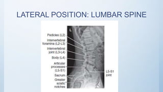 Radiographic views of lumbar spine | PPTX