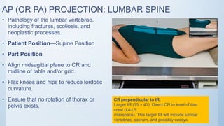 Radiographic views of lumbar spine | PPT