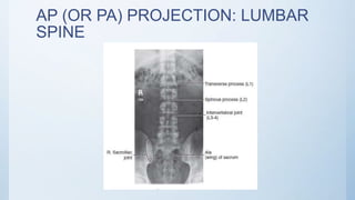 Ap Lumbar Spine Xray