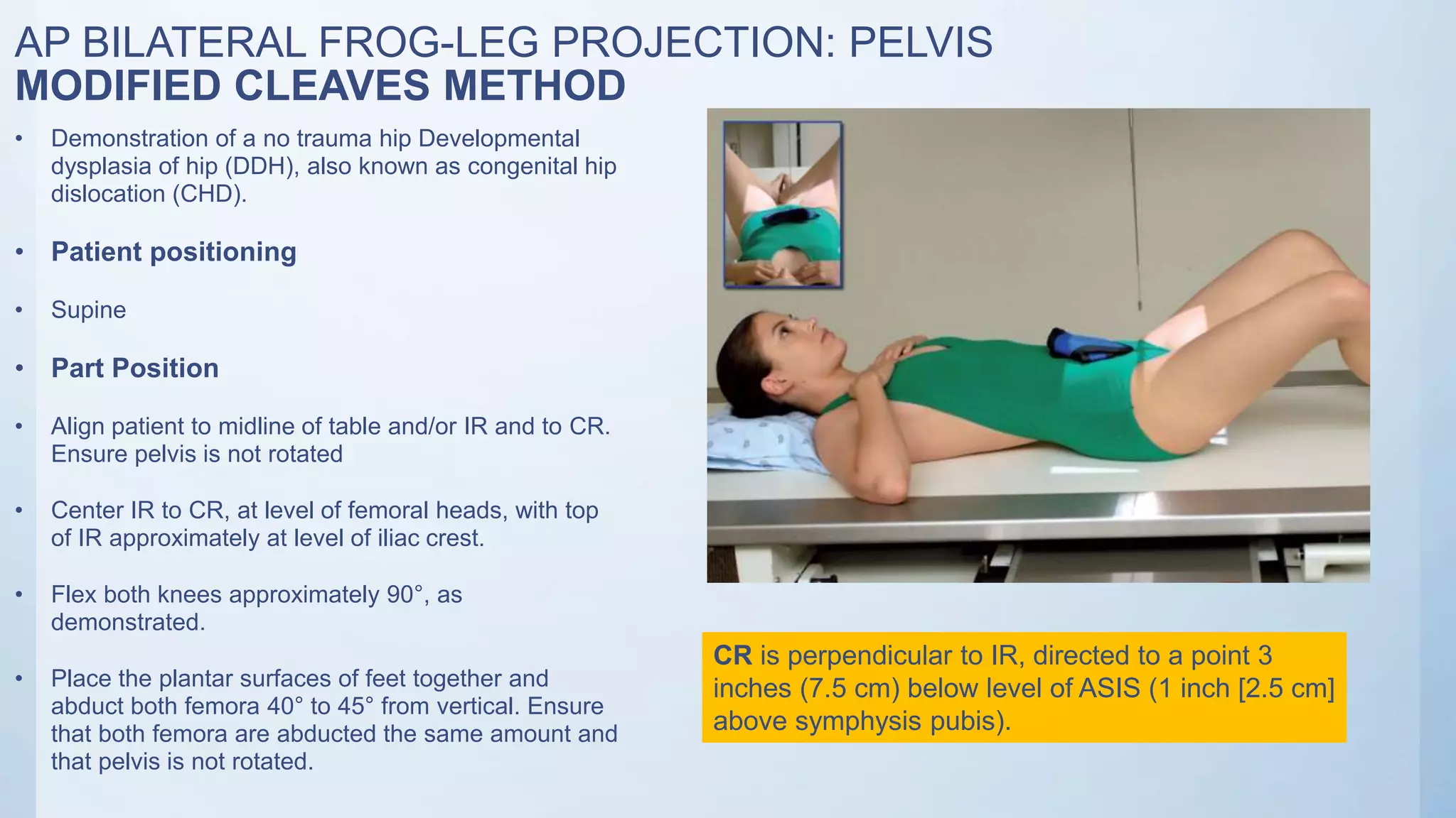 Radiographic views of proximal femur and pelvis | PPTX