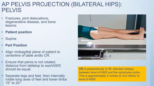 Radiographic views of proximal femur and pelvis | PPTX | Death, Injury ...