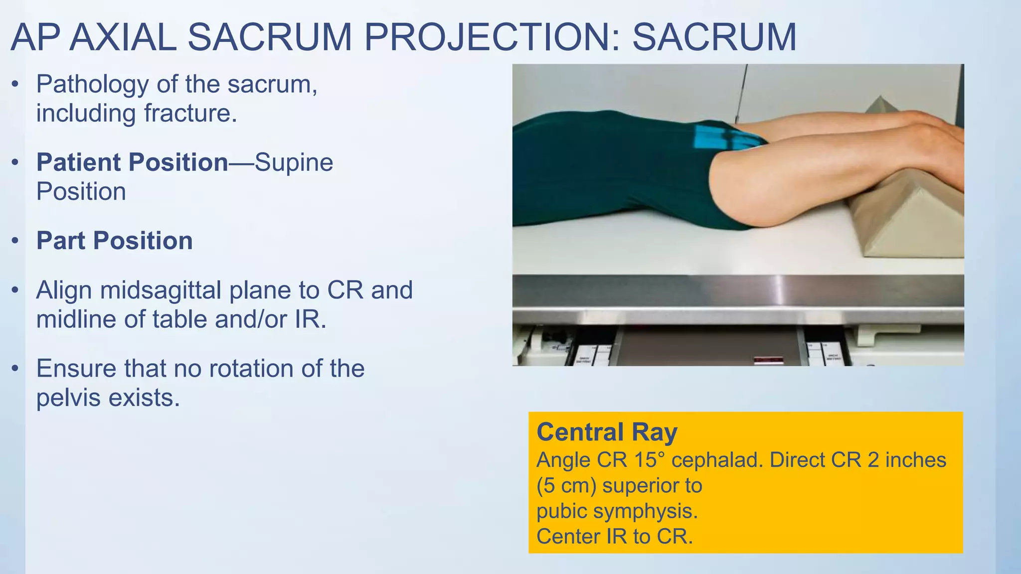 Radiographic views of sacrum and coccyx | PPTX