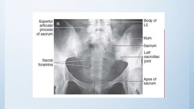 Radiographic views of sacrum and coccyx