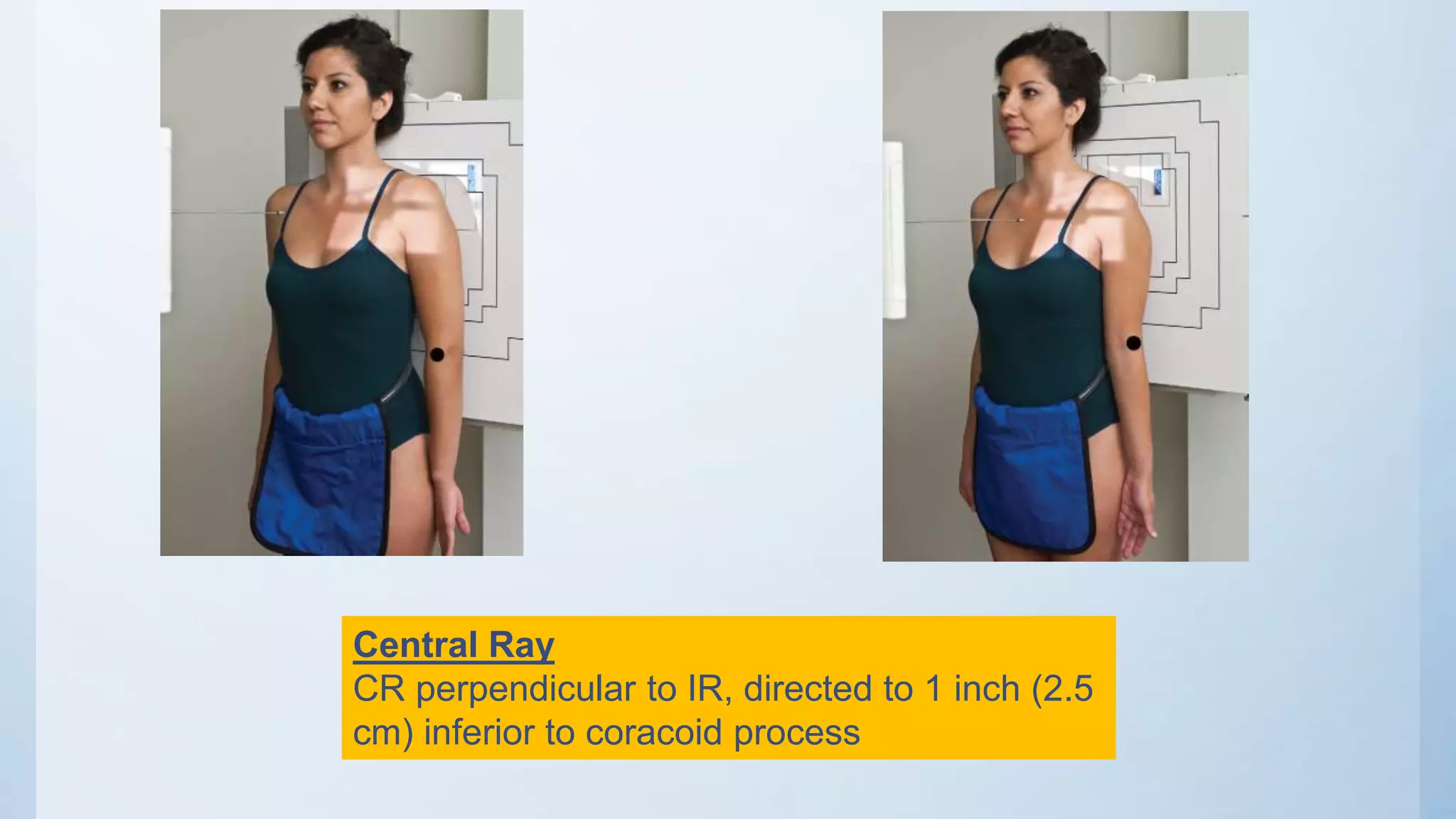 X ray views of shoulder joint and related structures | PPTX