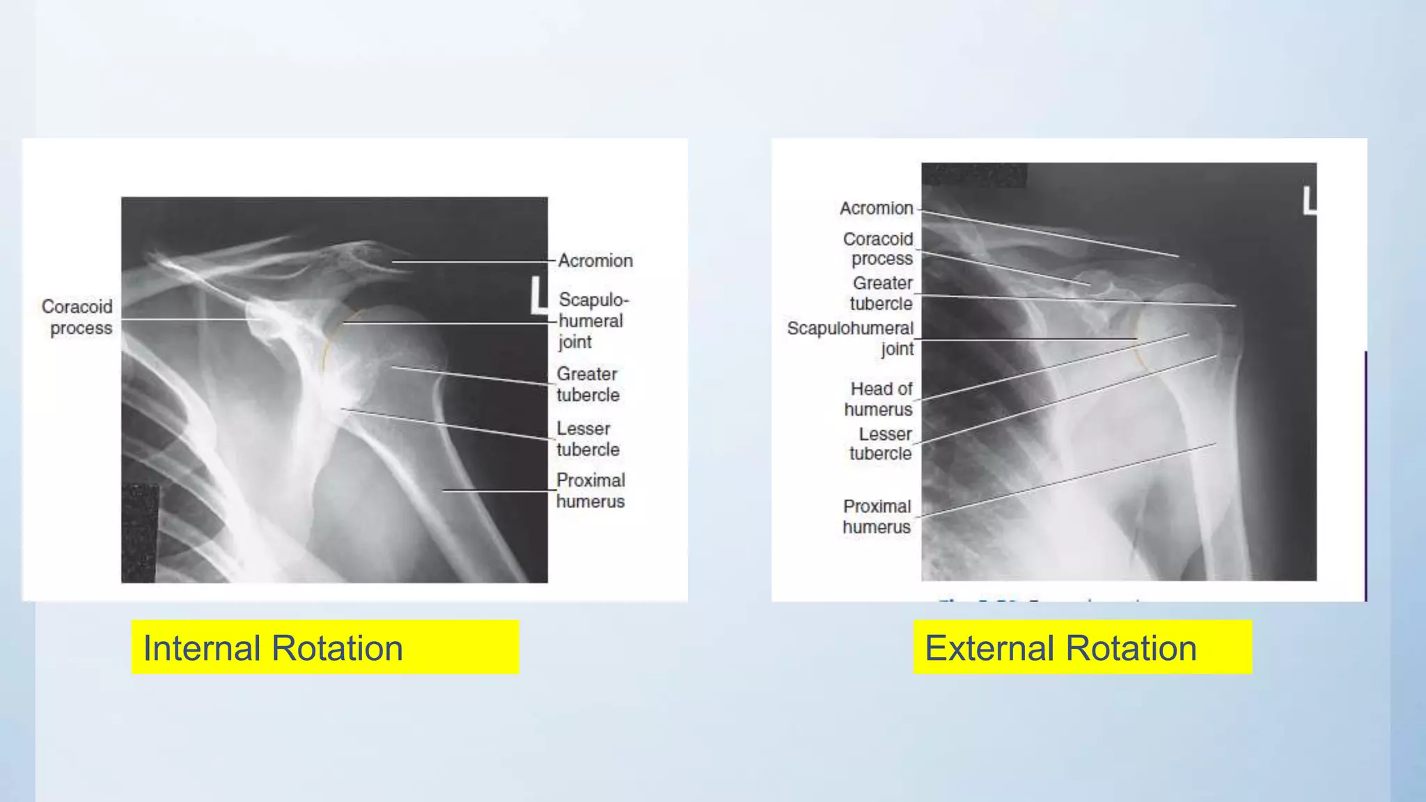 X ray views of shoulder joint and related structures | PPTX