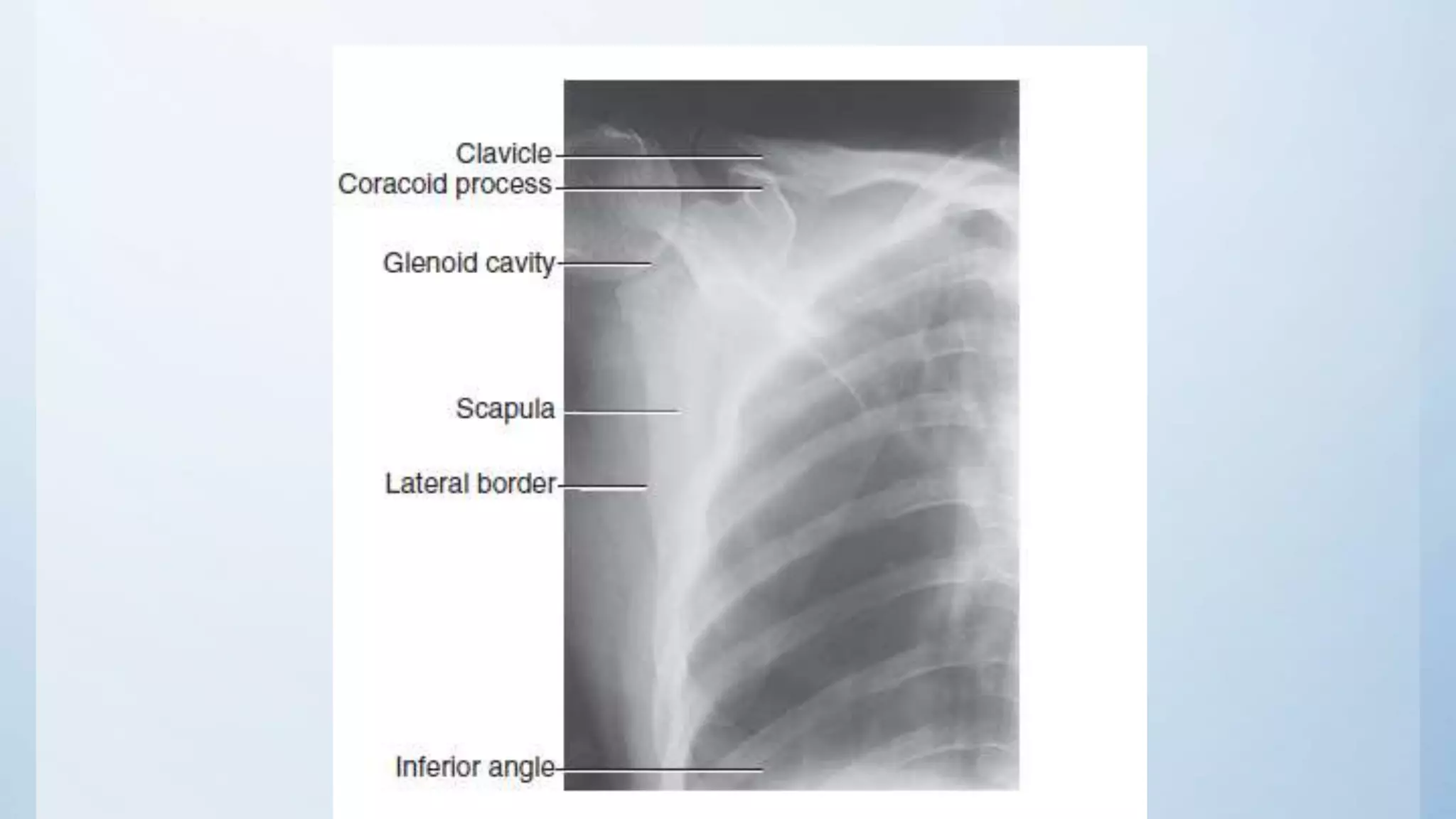 X ray views of shoulder joint and related structures | PPTX
